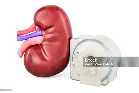 Mri를 사용한 인간의 신장 3d 렌더링 3d 스캔에 대한 스톡 사진 및 기타 이미지 3d 스캔 3차원 형태 Mri 스캐너 Istock