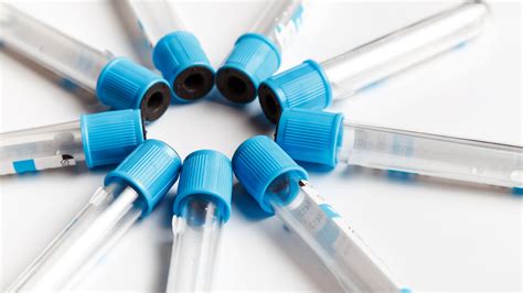 What Your Thyroid Labs Missed Del Negro Integrative Health