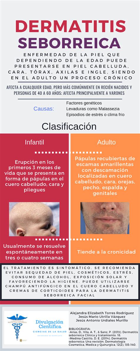 Seborrheic Dermatitis