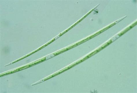 Protist Images Closterium Gracile