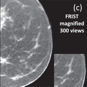 Example Of Sparse View 150 Views Reconstruction In Offset Detector Download Scientific