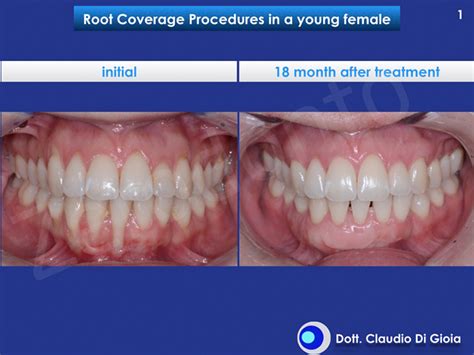 Perio Contest 2018 Online Voting Zerodonto