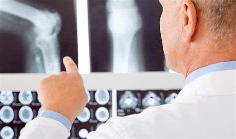 Измерване на костна плътност в Detox Center Detox Center