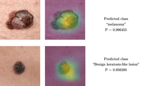 Grad Cam Activation Heatmap Visualization From Coatnet Model On