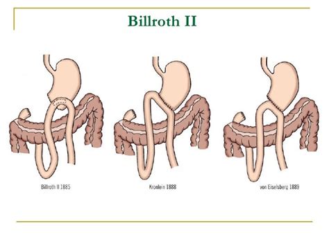 Anatomía Y Fisiología De Estómago