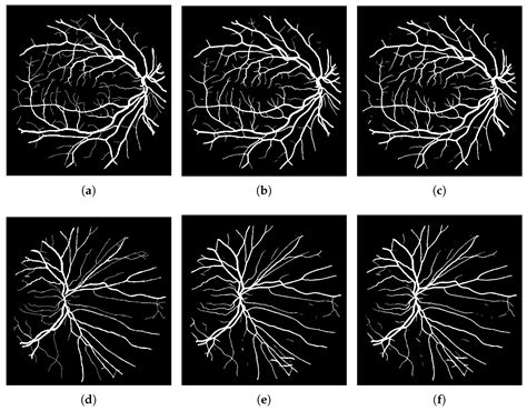 sensors free full text a retinal vessel segmentation method based