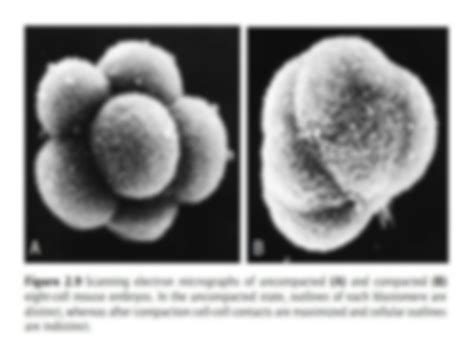 Solution Cleavage Morula And Blastocyst Studypool