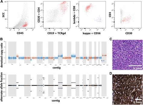 Integration Of Rna Sequencing Whole Exome Sequencing And Flow Cytometry Into Routine