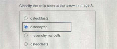 solved classify the cells seen at the arrow in image
