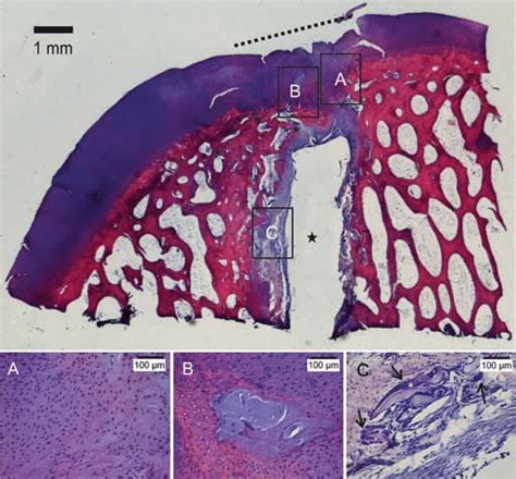 Panoramic View Of A Sample After 45 Months Implantation Of Pcl Download Scientific Diagram