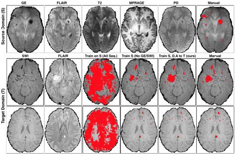 Unsupervised Domain Adaptation In Brain Lesion Segmentation With Adversarial Networks Deepai