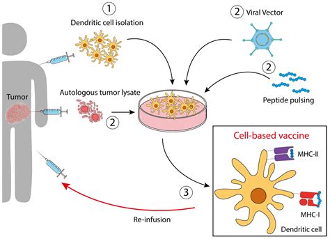 Cancer Vaccines From The State Of The Art To The Most Promising