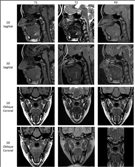 Setting Up An Mri Protocol Perry Lab For Craniofacial Imaging Ecu