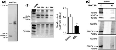Nnat Is Expressed In Murine Skeletal Muscle And Binds To Serca2a And