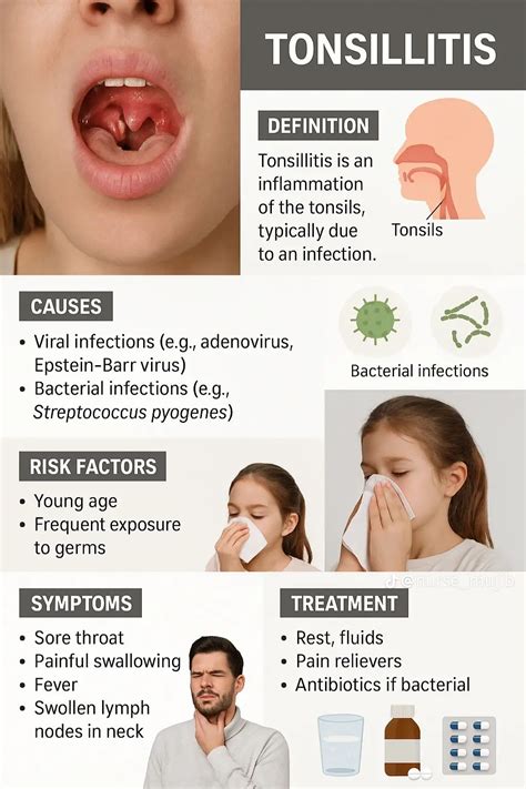 🦠tonsillitis 🦠 Review‼️ What Is It Inflammation Or Infection Of The