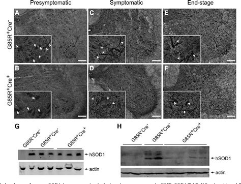 Figure 3 From The In Vivo Contribution Of Motor Neuron Trkb Receptors To Mutant Sod1 Motor