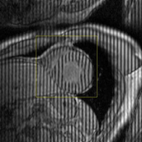 25 Four Detection Results The First One Shows That It Has Multiple