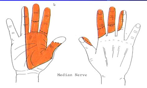 Neuromuscular Weakness Flashcards Quizlet Neuromuscular Weakness Flashcards Quizlet