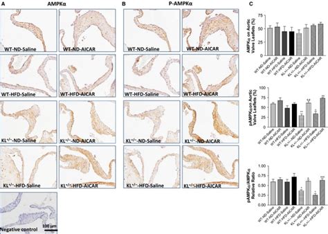 Deficiency In The Anti‐aging Gene Klotho Promotes Aortic Valve Fibrosis Through Ampkα‐mediated