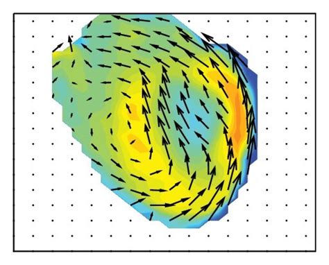 Synthetic Intraventricular Velocity Fields And Out Of Plane Vorticity Download Scientific