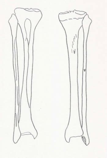 Figures Femur Fibula Patella And Tibia Introduction To Human Osteology