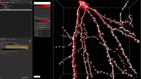 Creating A Surface In Imaris Queensland Brain Institute University