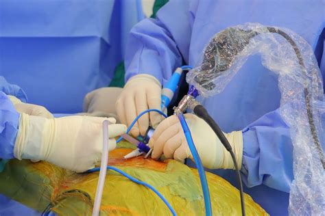 Гэмтлийн эмнэлэг нурууны дурангийн мэс заслыг эмчилгээнд нэвтрүүллээ