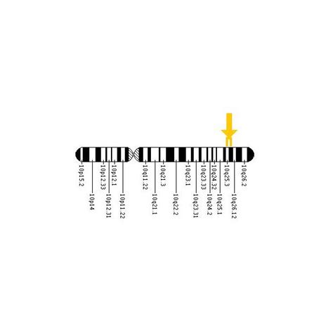 Apert Syndrome Part 2 Intelligent Dental