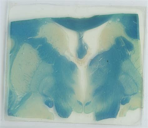 Human Brain Eye Microscope Large Slide Set Neuropathology Study Vintage Medical 4654197900