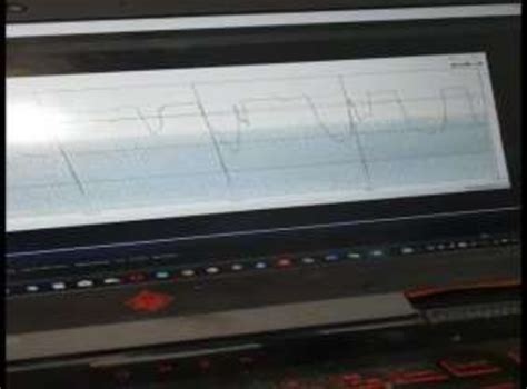 Emg Signal Generation G Finger Kinematics In The Kinematics Form The Download Scientific