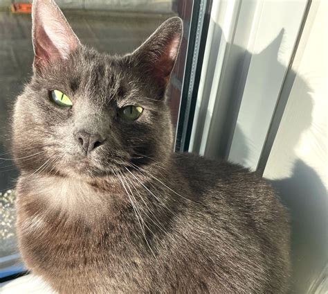 Another Successful Craniectomy Surgery Performed By Bridge Referrals