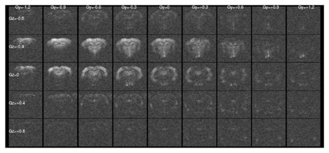 Asymmetric Spin Echo Data In A Single Slice At τ 56 Ms As For Figure Download Scientific