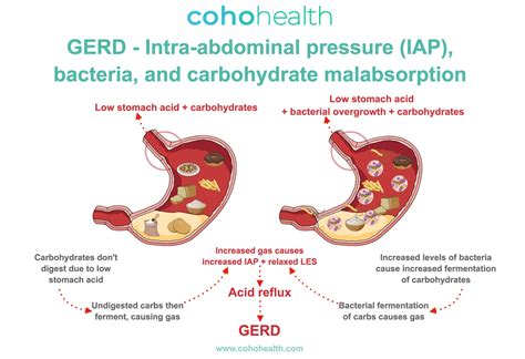 The Functional Medicine Approach To Gerd Feel Better Faster