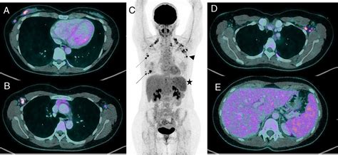 Clinical Nuclear Medicine