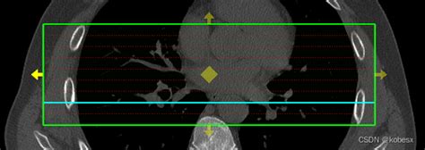 医学图像处理软件实战开发 QT C VTK 3 qt医学软件 CSDN博客