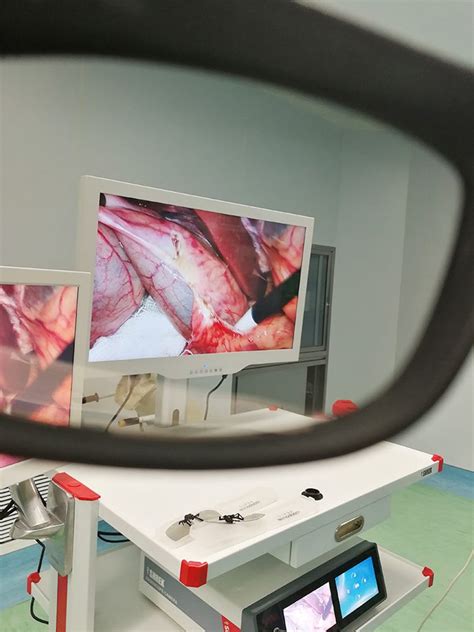 3d Laparoscopic Surgery Shanghai Shiyin Photoelectric Instrument Co Ltd