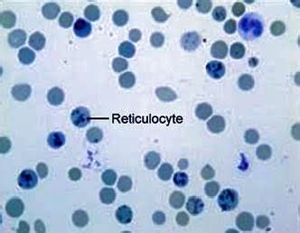 What Is The Reticulocyte Count Test And Why Adviced By Doctors