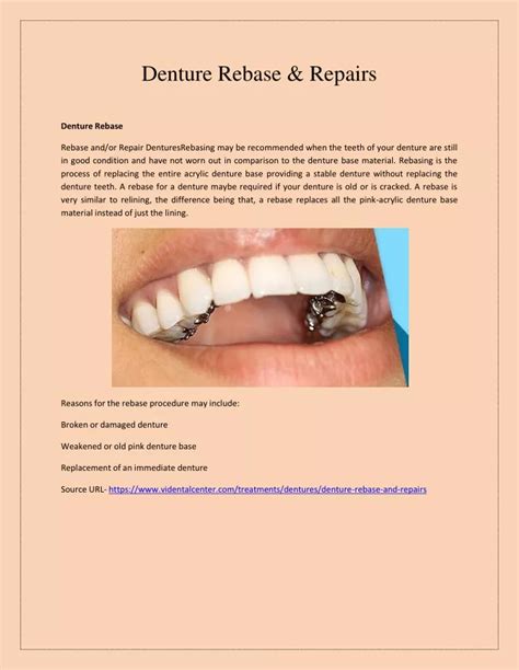 Ppt Denture Rebase And Repairs Powerpoint Presentation Free Download