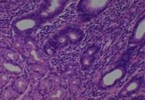 Novus Biologicals Human Multi Tissue Tissue Microarray Cancer Human