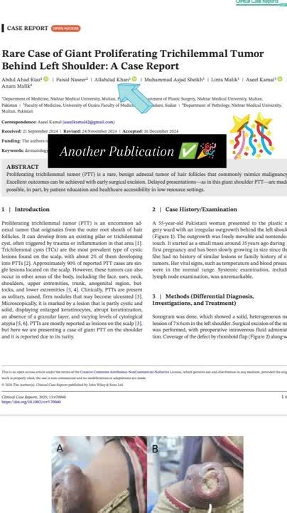 Allahdad Khan On Linkedin I Am Pleased To Announce Publication Of A Case Report Titled Rare