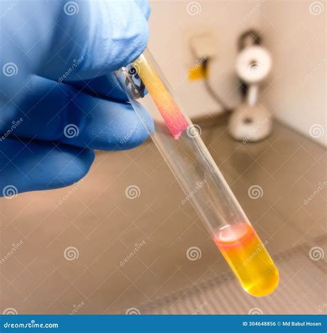 Salmonella Detection Method By Using Triple Sugar Iron Tsi Agar In