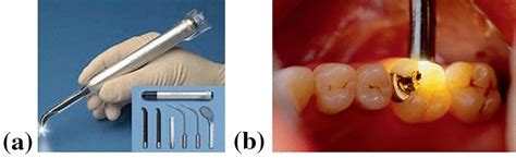 Fiber Optic Transillumination A Instrumentation B Clinical Use