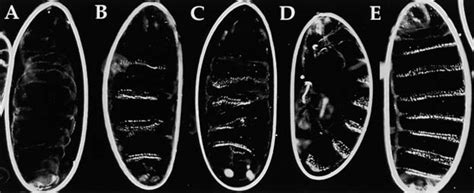 Embryonic Lethal Phenotypes Associated With Ngt Driven Expression Of Download Scientific