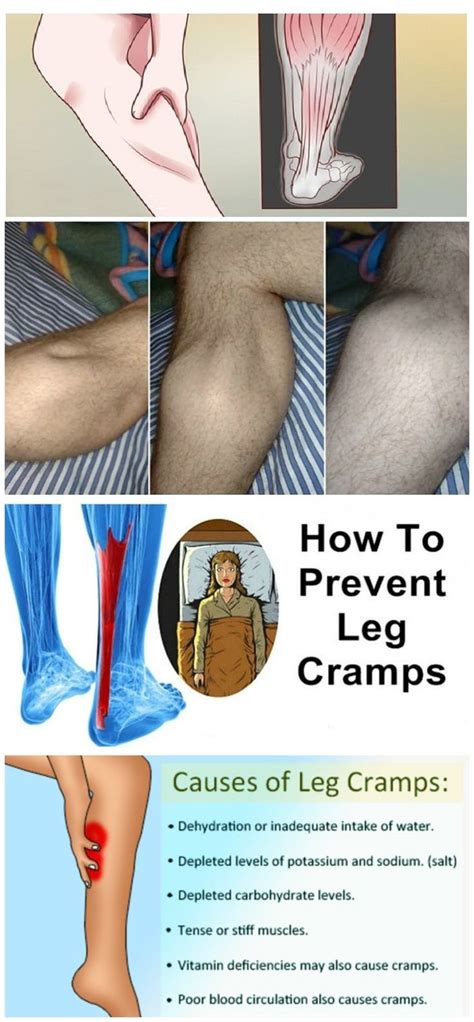 31 Best Siatic Nerve Ideas Back Pain Massage Therapy Sciatica