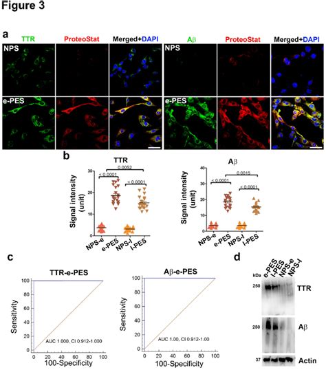 Identification Of Protein Components Of The Aggregates In Pe Serum