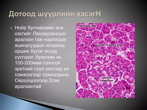 нойр булчирхай Pptx