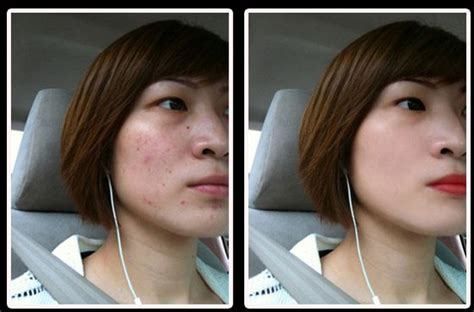 How To Remove Pimple Marks From The Face Beauty Hacks How To Remove Pimples Diy Pimple Treatment