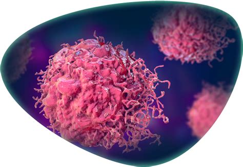 Pancreatic Cancer Bpgbio