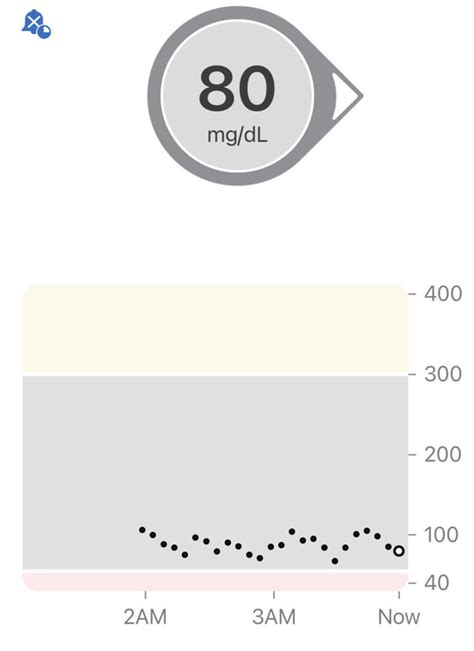The Zig Zag Pattern What Does It Mean Rdexcom