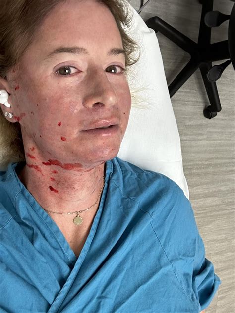 Large Volume Electrolysis Rtranslater